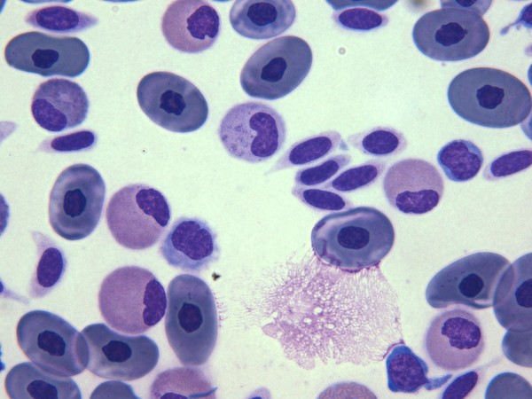 A first look at the biochemistry of whale sharks | Deep Sea News